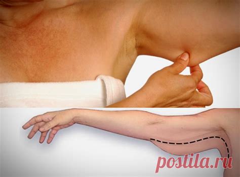 Как избавиться от дряблости рук 3 простых упражнения не вставая с див Все обо Всем Постила