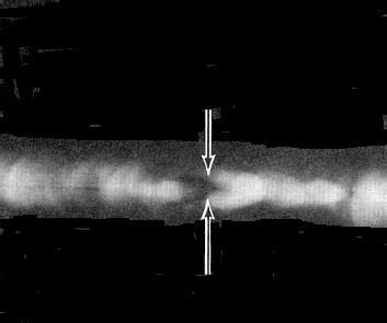 Weld Defects Classification Dataset And Pre Trained Model By Asd
