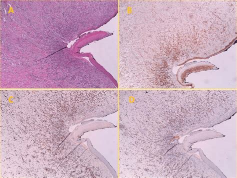 Histological And Immunohistochemical Sections A Hematoxylineosin