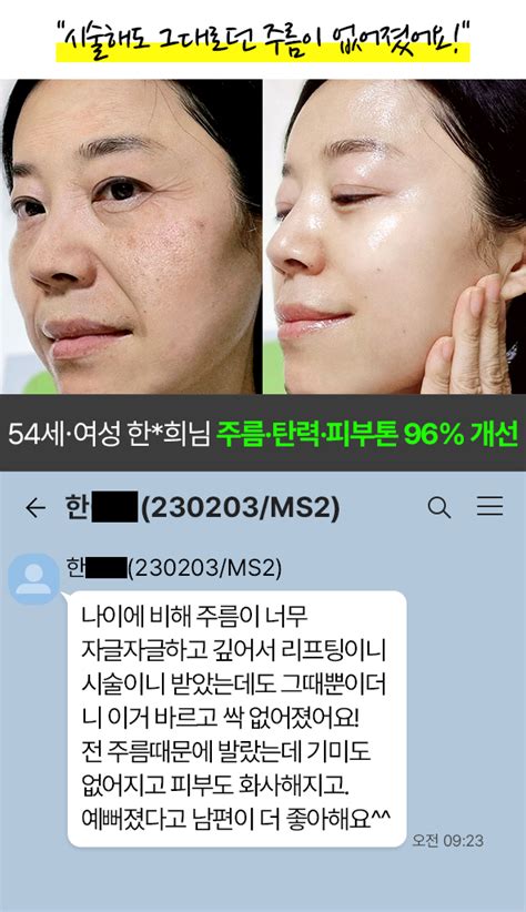 지겨운 주름·기미를 한번에 Ms2