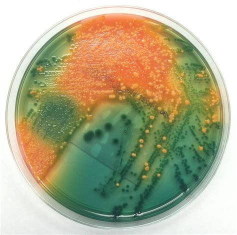 On Hektoen Enteric Agar Microbiology Microbiology Lab 56 Off