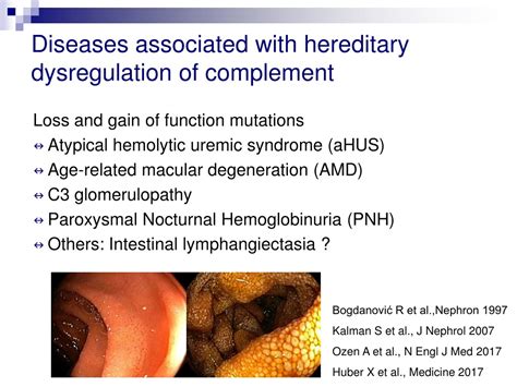PPT Complement System Functions And Dysregulation In Diseases PowerPoint Presentation ID