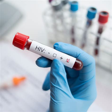 National Hiv Testing Day The Urgent Care