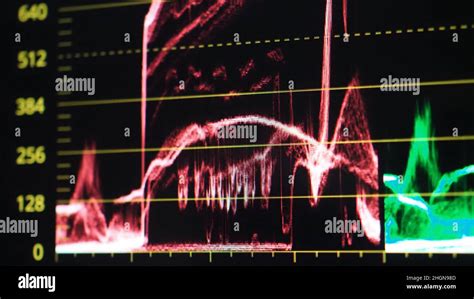 Color Grading Graph Or Rgb Colour Correction Indicator On Monitor In