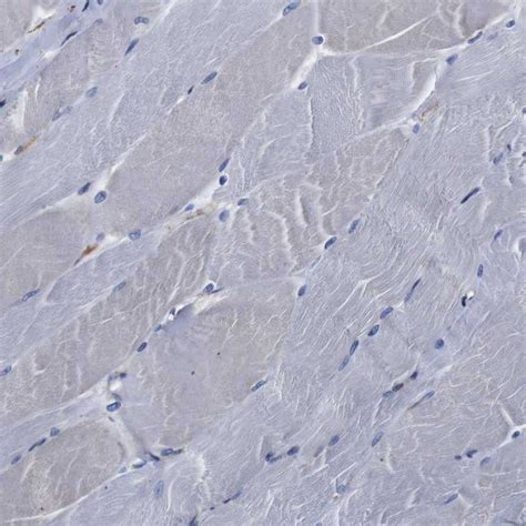 Rabbit Polyclonal Anti Ppib Antibody Buy For Research Highly