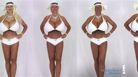 Galerie Martina Big Po Přeměně Na černošku Chci Ještě Větší Prsa