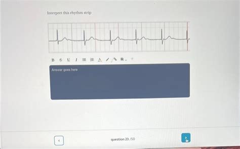 Solved Interpret This Rhythm Strip Interpret This Rhythm