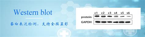 技术服务 Western Blot检测