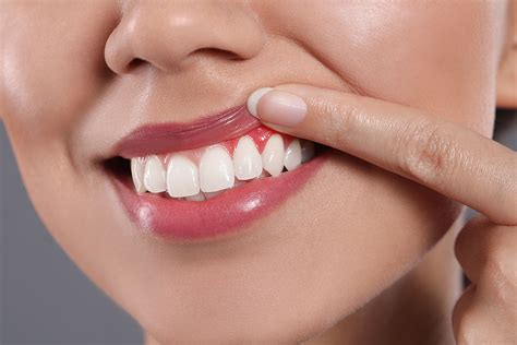 San Antonio Tx Gum Disease Treatment Regain Oral Health Advanced