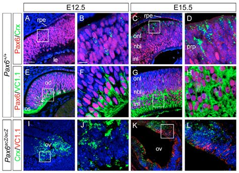 Differential Response To Pax6 Loss In Subpopulations Of Pax6 Laczlacz