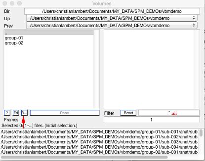 Preprocessing Spm Documentation