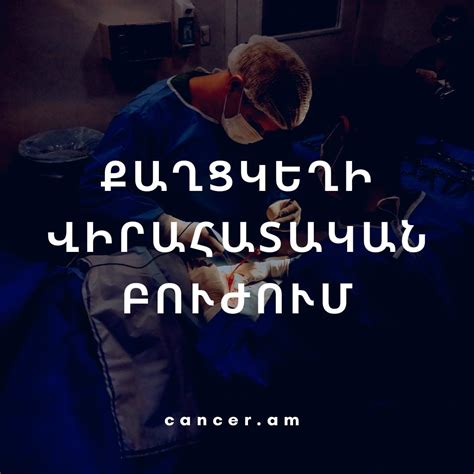 Cancer Am Ամեն ինչ քաղցկեղի մասին
