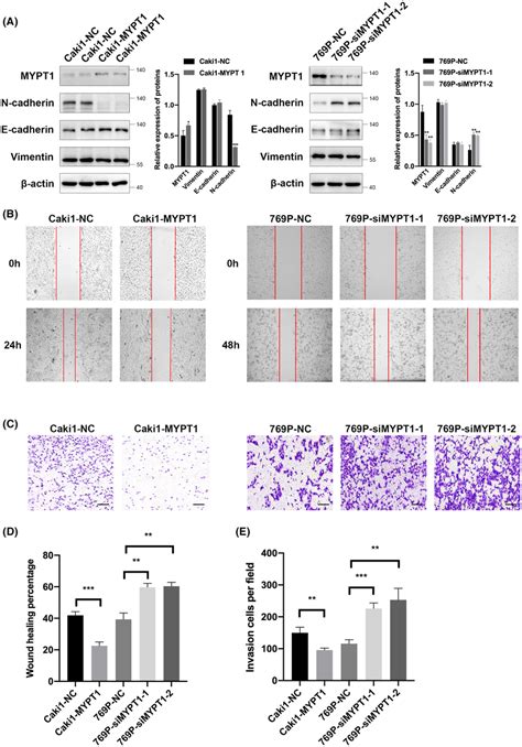 Mypt1 Overexpression Or Knockdown Influenced The Migration And Invasion