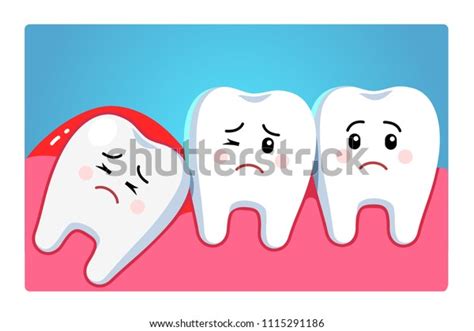 Impacted Wisdom Tooth Character Pushing Adjacent Stock Vector Royalty Free 1115291186