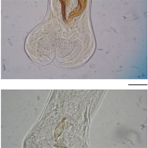 Normal Up And Abnormal Bottom T Retortaeformis Male Genital Cone