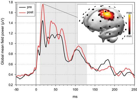 Responses To TMS Before And After Hz Conditioning Total Activation