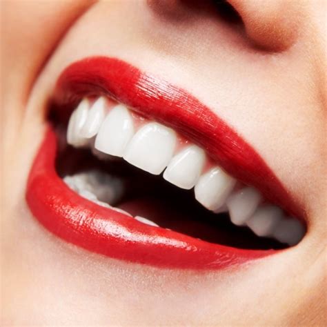 Consejos para mantener una sonrisa sana también en Navidad
