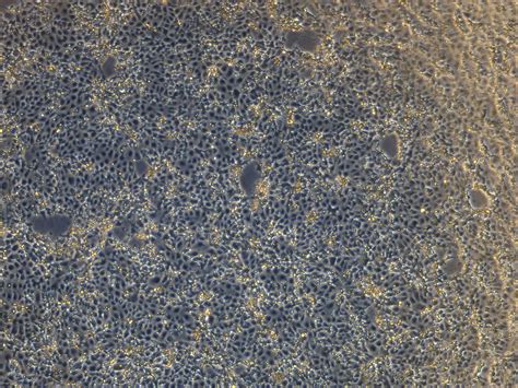 Any Possible Explanation For The Cell Death During Rpe Differentiation