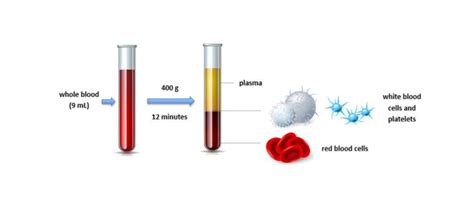 L Prf With Three Components After Centrifugation Download Scientific Diagram