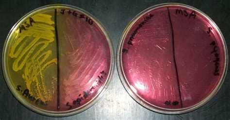 Selective And Differential Media Hands On Microbiology