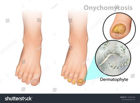 1762 Wynikiów Dla „background Tinea” W Kategorii Obrazy Stockowe Zdjęcia I Wektory