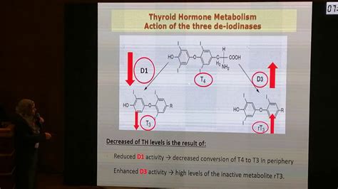 Feb 2020 Sick Euthyroid Syndrome Youtube