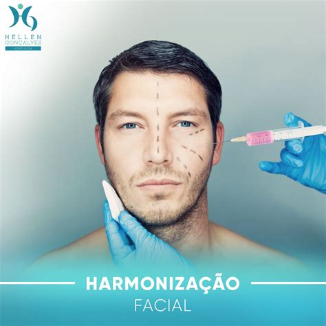 Mas afinal o que é HARMONIZAÇÃO FACIAL Harmonização Facial é um