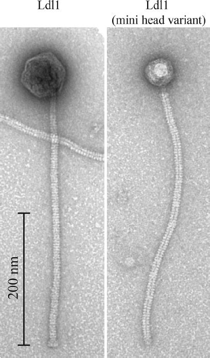 Transmission Electron Micrographs Of L Delbrueckii Subsp Lactis Phage