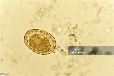 Ascaris Lumbricoides En Heces Foto De Stock Y Más Banco De Imágenes De