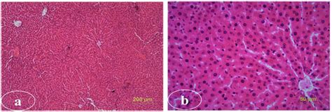 Photomicrograph Of Liver Sections Stained With Hematoxylin And Eosin