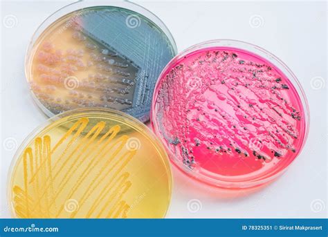 Bacterial Colonies Culture On Differential And Selective Media Stock Image Image Of Grains