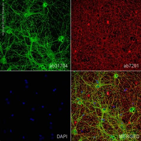 Anti Dcamkl1 Antibody Ko Validated Ab31704 Abcam