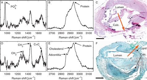 Figure 1 From Fingerprint And High Wavenumber Raman Spectroscopy In A