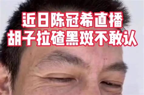 陈冠希近日直播胡子拉碴，表示撞脸赵本山，昔日男神要消失了吗？凤凰网视频凤凰网