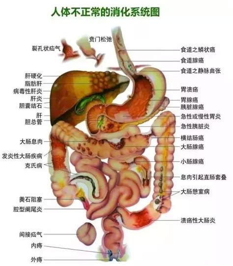 震驚腸道垃圾對身體的危害有多大看完嚇一跳 每日頭條