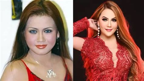 Beda Penampilan 9 Artis Sebelum Vs Setelah Operasi Plastik Bikin