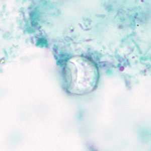 Cdc Dpdx Cyclosporiasis