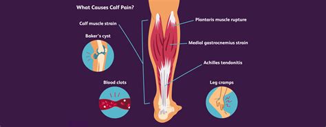 Calf Strain Motus Physical Therapy