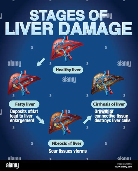 Pycnogenol And Liver Damage At Steve Bushnell Blog