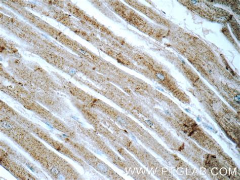 E Cadherin Antibody 20874 1 Ap Proteintech