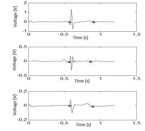Determination Of The Qt Segment Download Scientific Diagram