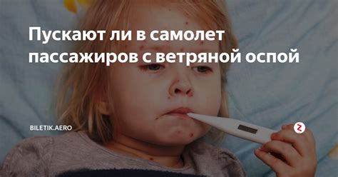 Пускают ли в самолет пассажиров с ветряной оспой Strike Дзен