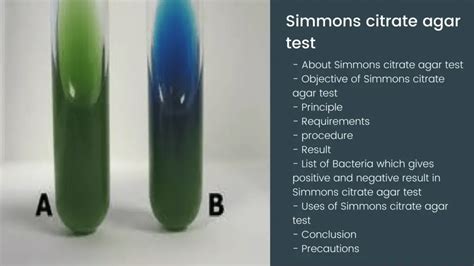 API Analytical Profile Index 20E Test Result Principle Procedure