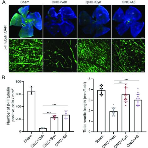 Onc Induced Degradation Of Optic Nerve Myelination Was Partially