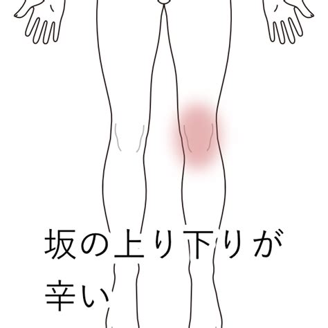 膝の痛みで坂を上るのが辛い｜膝痛のツボ｜ツボネット 鍼灸の症例が検索できるツボ辞典
