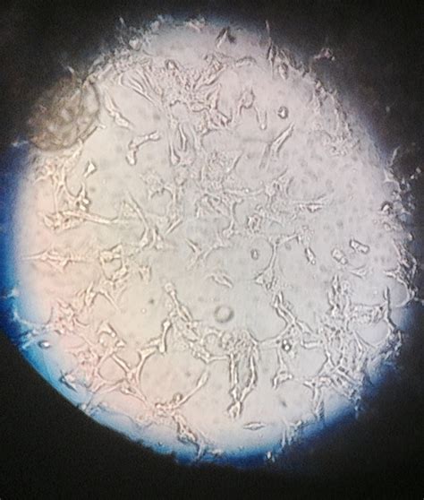 What Confluency Is This Cell Culture Researchgate