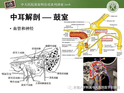 中耳解剖及中耳病变影像诊断 医学影像
