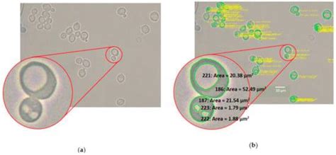 Tim Faith On Linkedin Yeast Morphology Assessment Through Automated