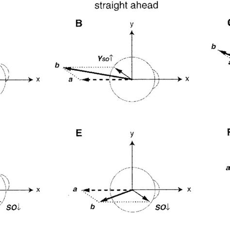 Example Of Static Bielschowsky Head Tilt Testing In Right Congenital Download Scientific