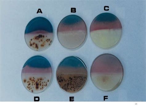 Siderophores Ppt